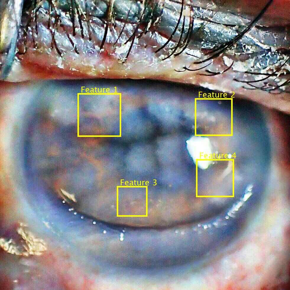 Post-mortem Iris Decomposition and its Dynamics in Morgue Conditions | DeepAI