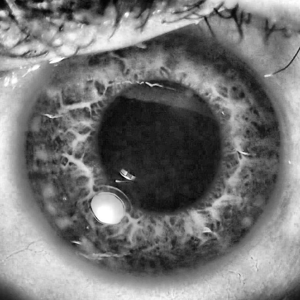 Post-mortem Iris Decomposition and its Dynamics in Morgue Conditions | DeepAI