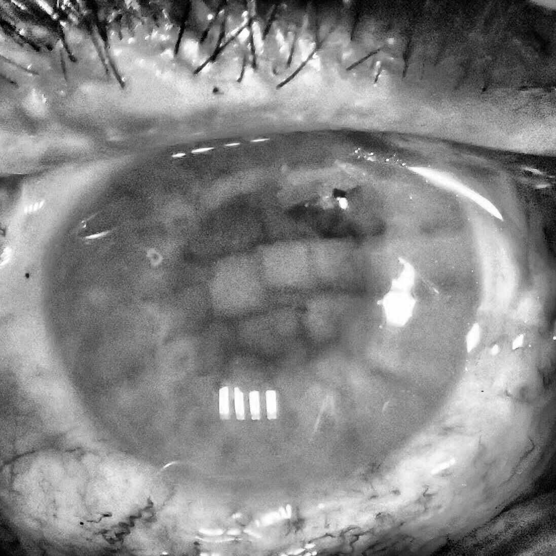 Post-mortem Iris Decomposition and its Dynamics in Morgue Conditions | DeepAI