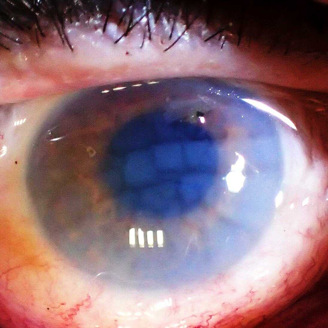 Post-mortem Iris Decomposition and its Dynamics in Morgue Conditions | DeepAI