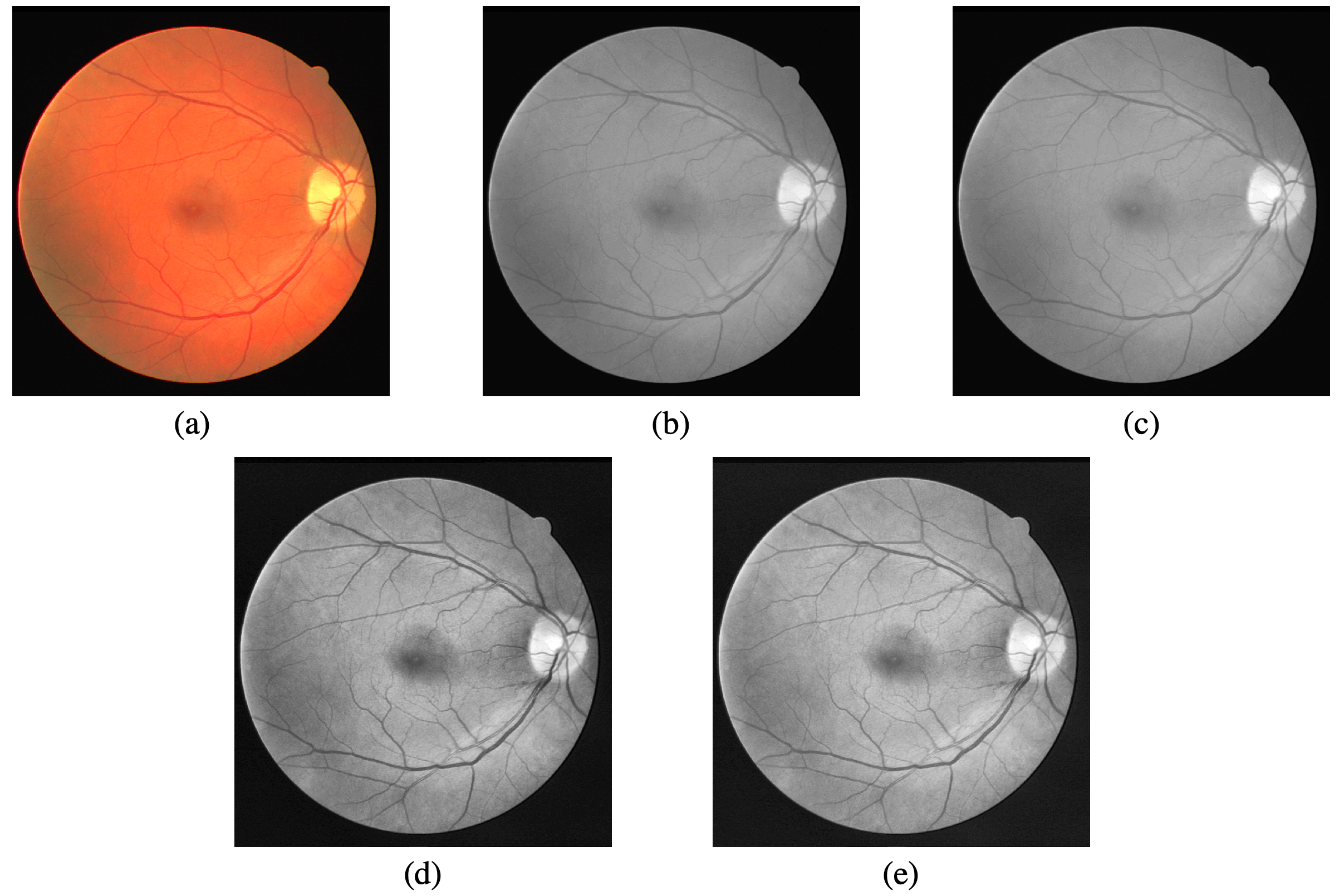 Retinal Vessel Segmentation based on Fully Convolutional Networks | DeepAI