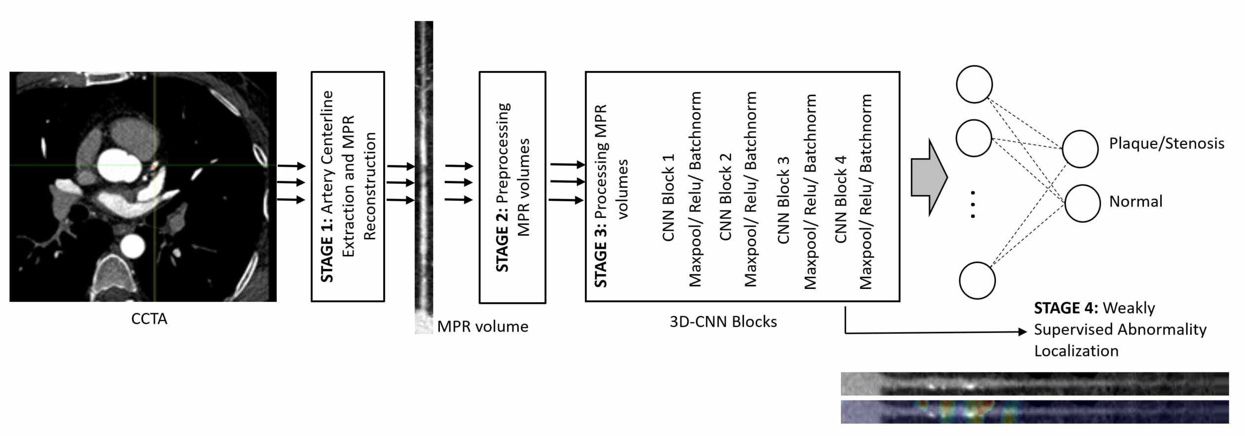 Coronary Artery Classification and Weakly Supervised Abnormality ... Coronary Artery Classification and Weakly Supervised Abnormality ...
