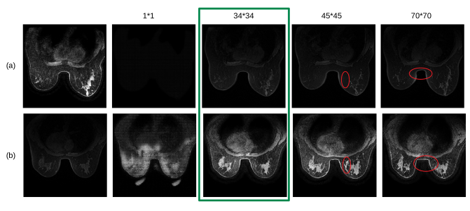 Normalization of breast MRIs using Cycle-Consistent Generative ... Normalization of breast MRIs using Cycle-Consistent Generative ...
