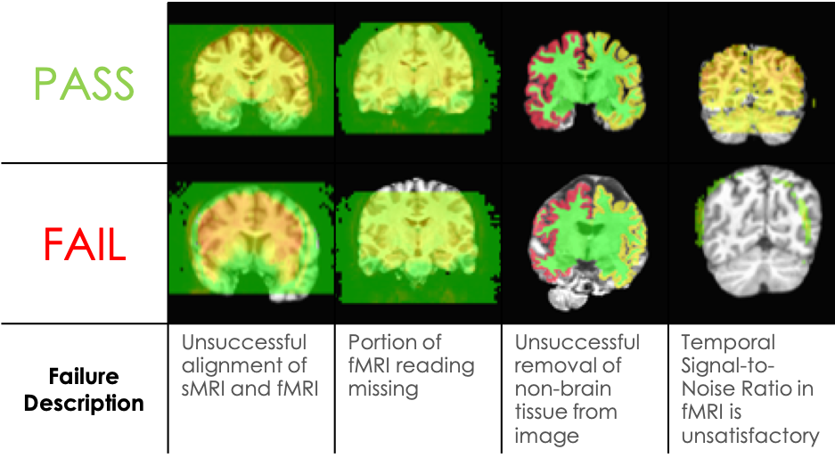 A Generalizable Method for Automated Quality Control of Functional ...