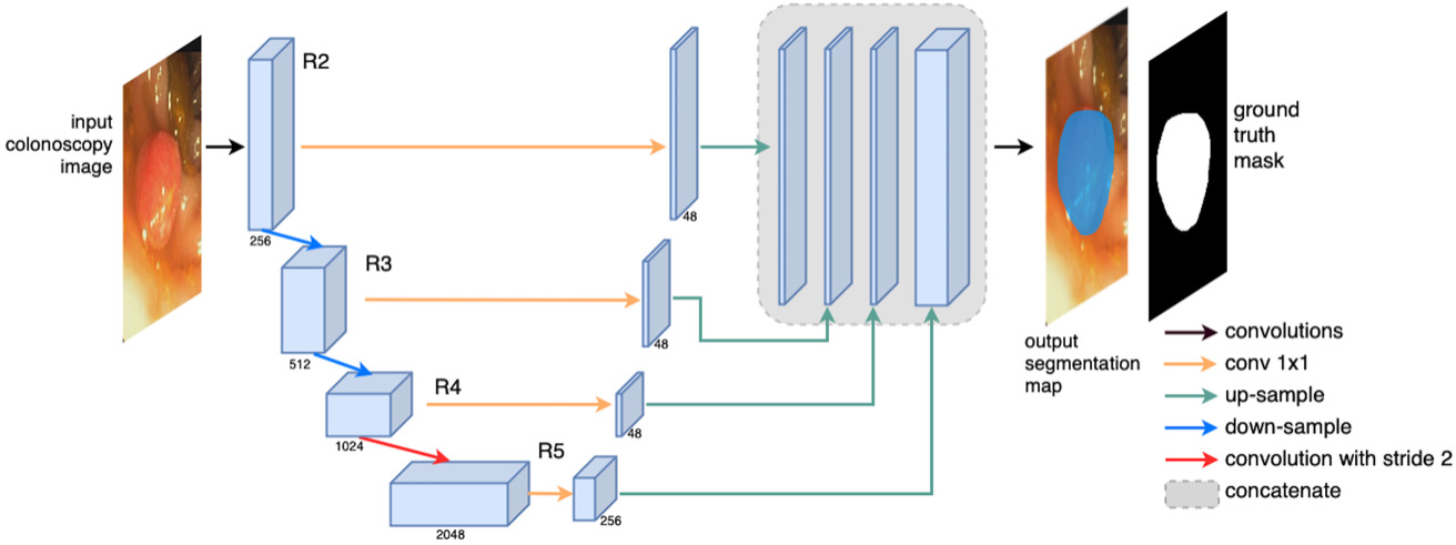 Colorectal Polyp Segmentation by U-Net with Dilation Convolution | DeepAI