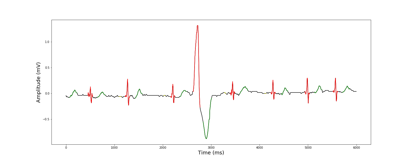 Deep Learning for ECG Segmentation | DeepAI