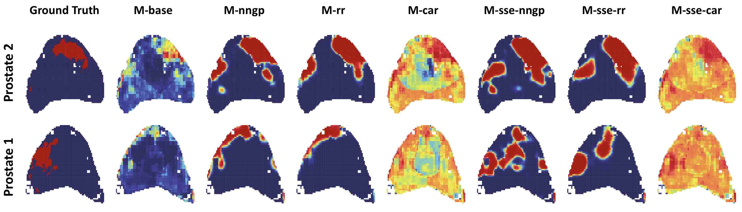 Bayesian Spatial Models for Voxel-wise Prostate Cancer Classification Using Multi-parametric MRI ...