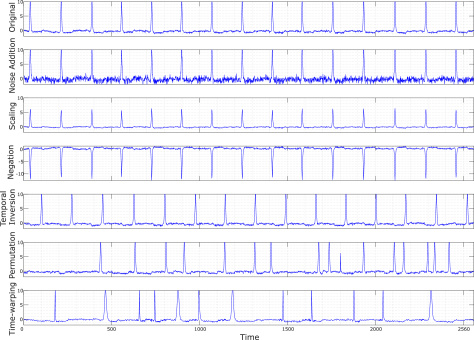 Self-supervised ECG Representation Learning for Emotion Recognition | DeepAI