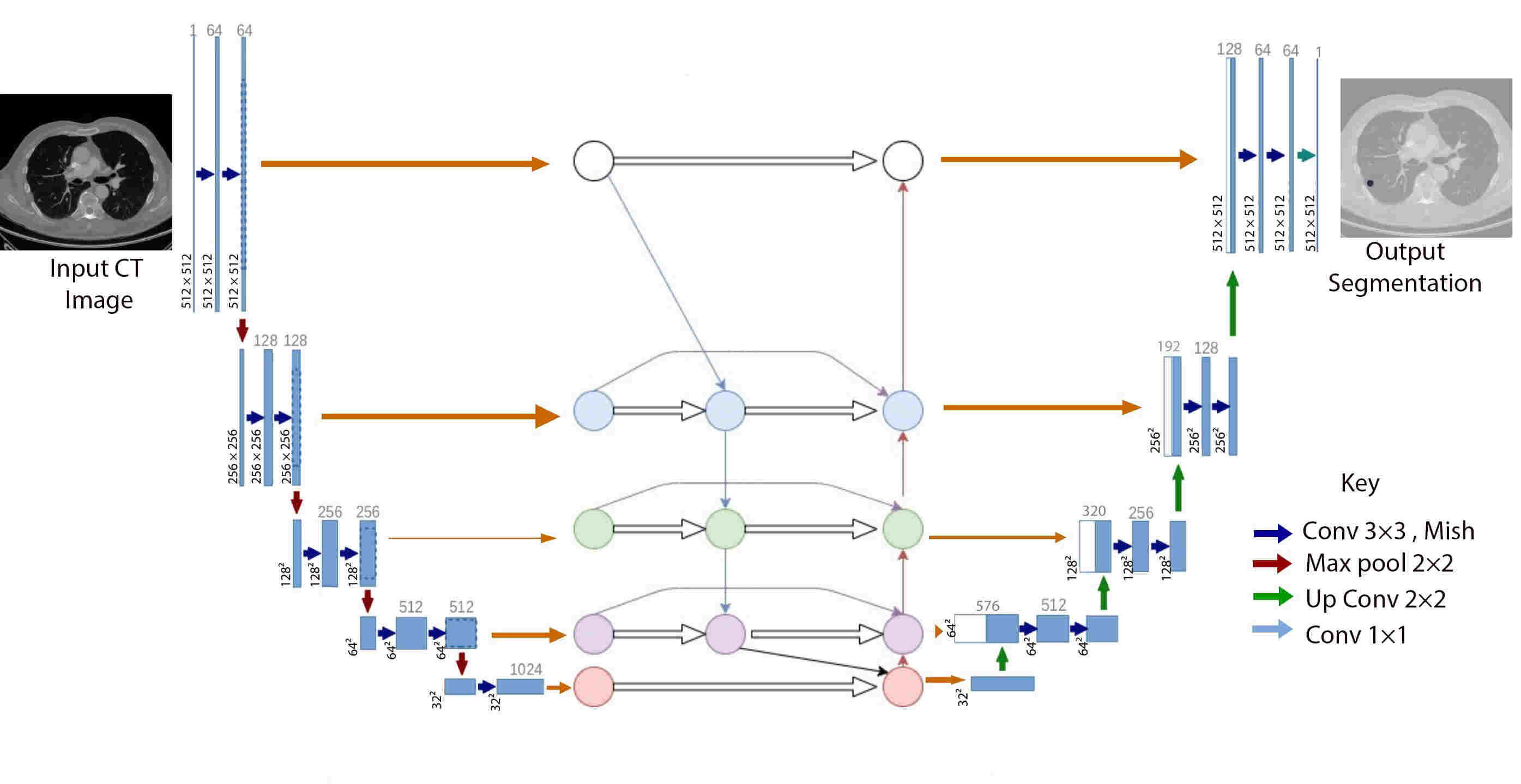 U-Det: A Modified U-Net architecture with bidirectional feature network for lung nodule ...