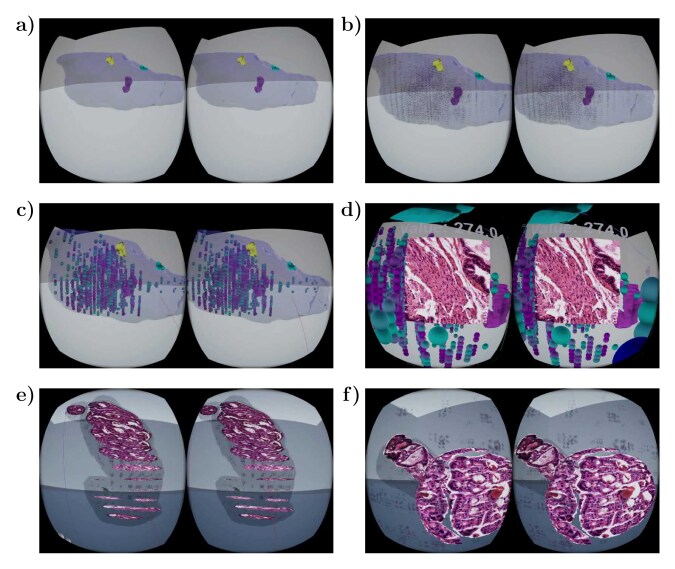 Virtual reality for 3D histology: multi-scale visualization of organs ...