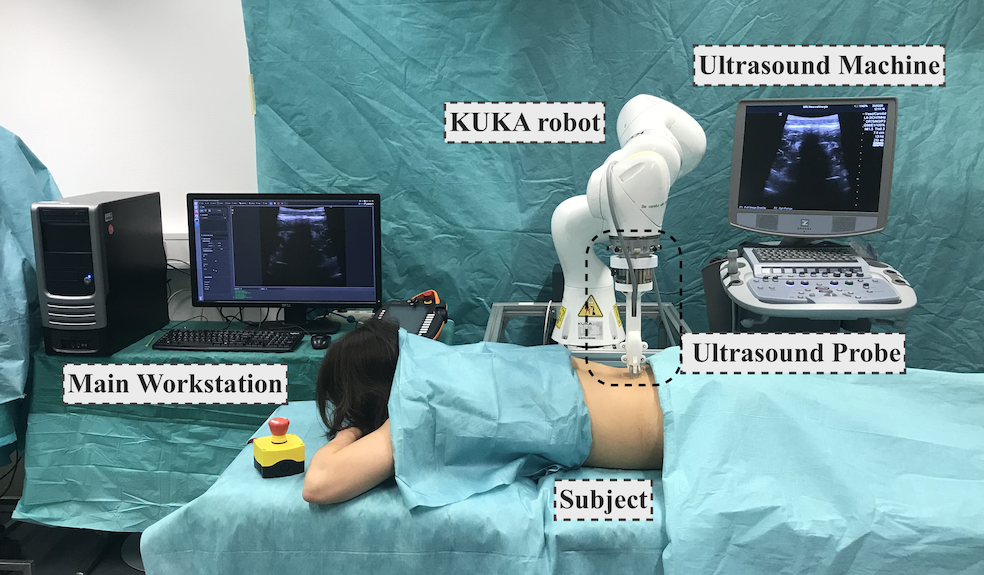 Ultrasound Guided Robotic Navigation With Deep Reinforcement Learning Deepai
