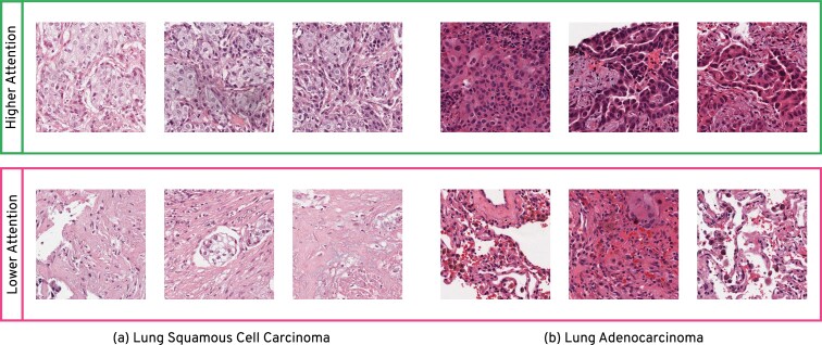 Representation Learning of Histopathology Images using Graph Neural Networks | DeepAI