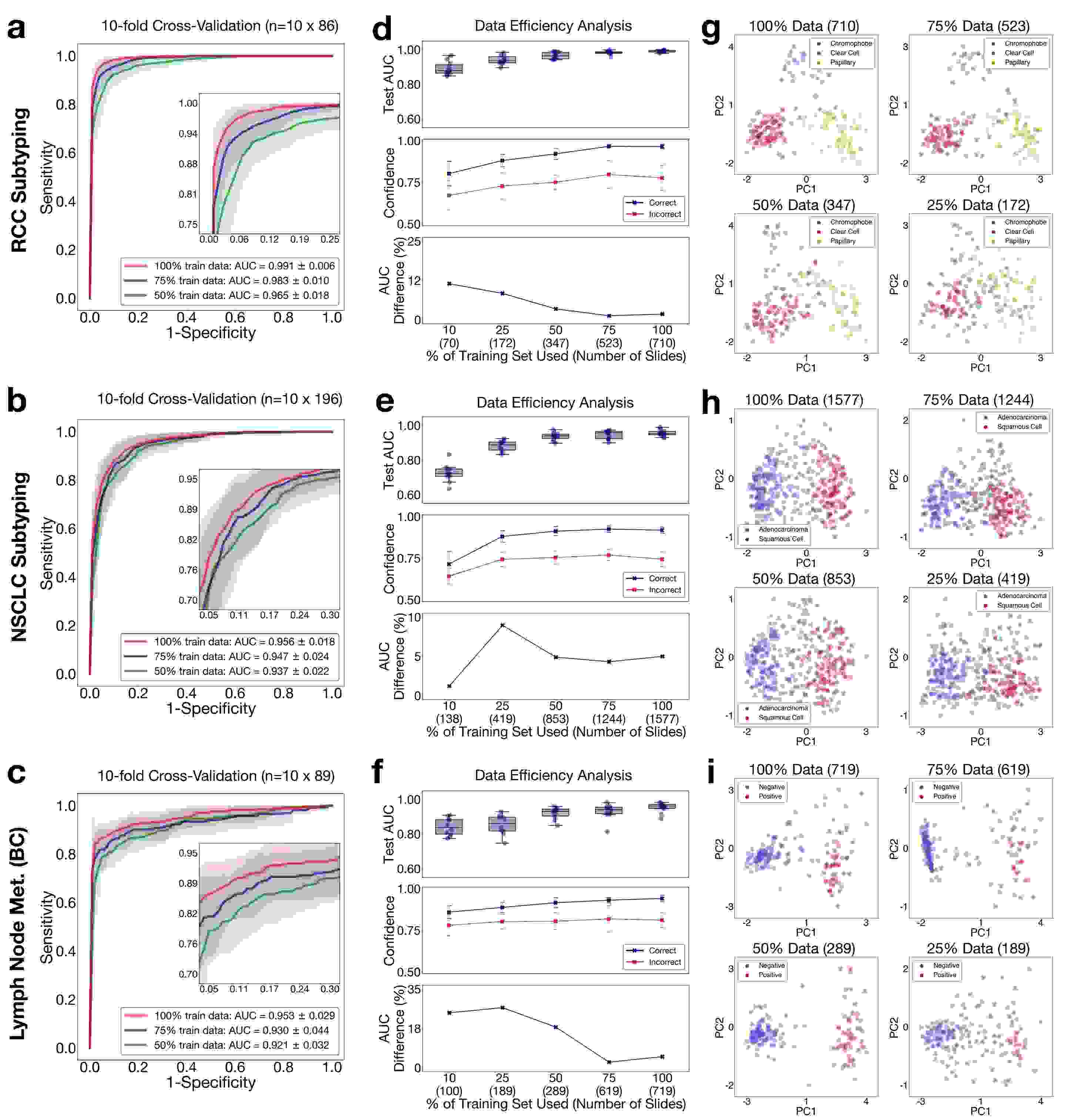 Data Efficient and Weakly Supervised Computational Pathology on Whole Slide Images | DeepAI