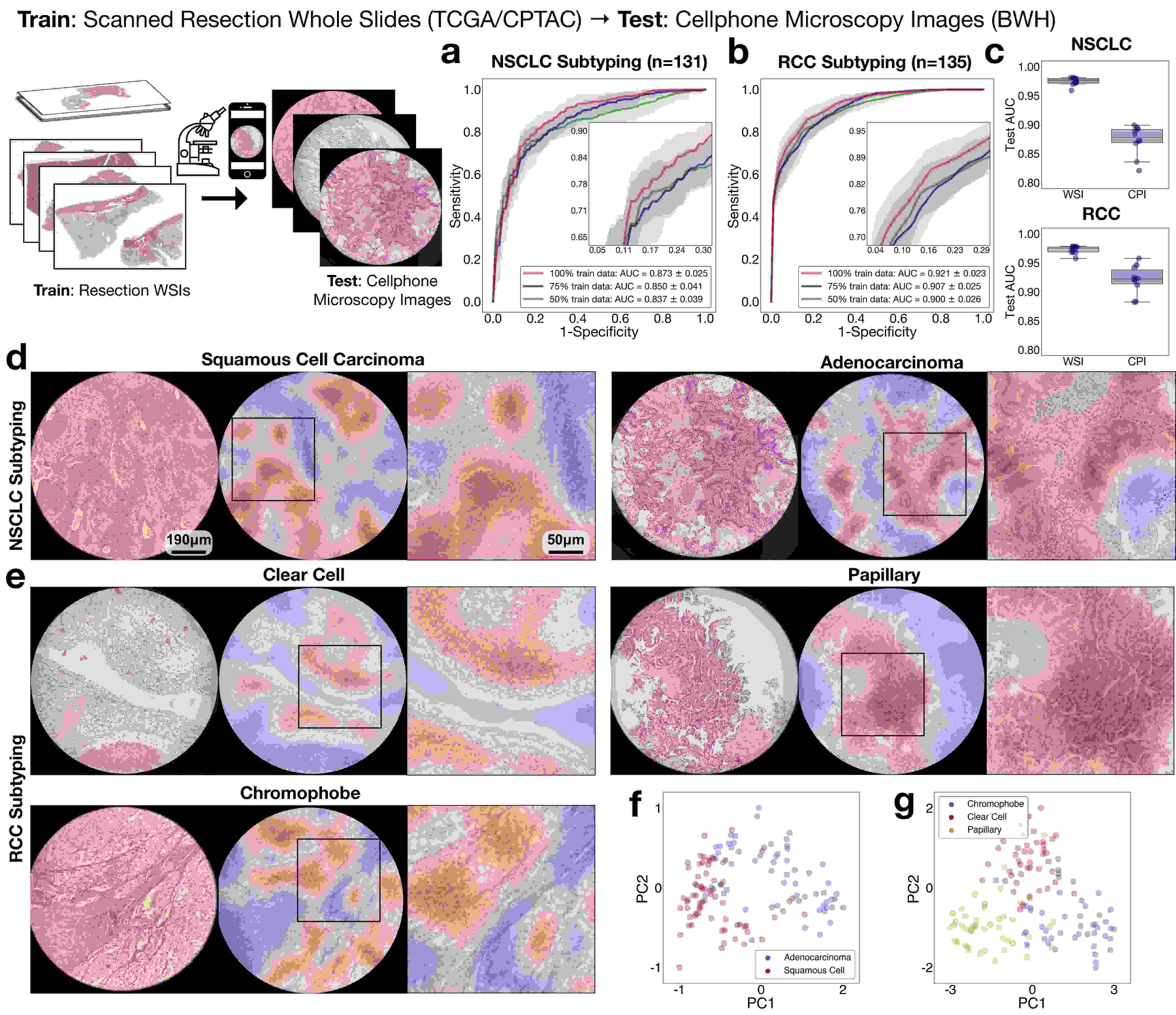 Data Efficient and Weakly Supervised Computational Pathology on Whole Slide Images | DeepAI