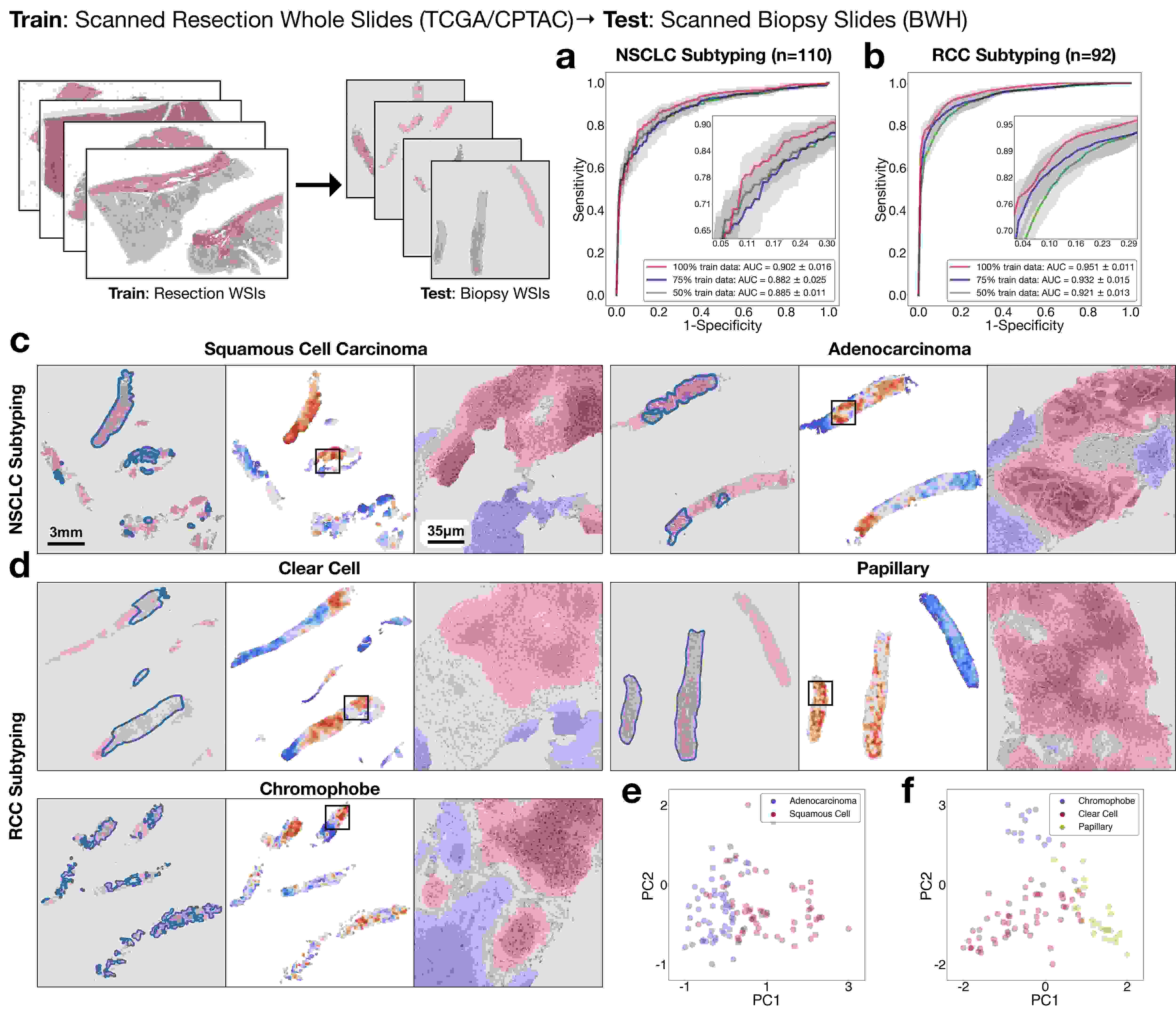 Data Efficient and Weakly Supervised Computational Pathology on Whole Slide Images | DeepAI
