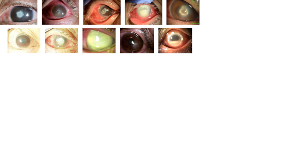 Automated eye disease classification method from anterior eye image ...
