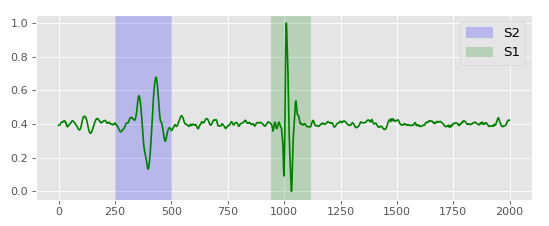 Understanding the Importance of Heart Sound Segmentation for Heart ...