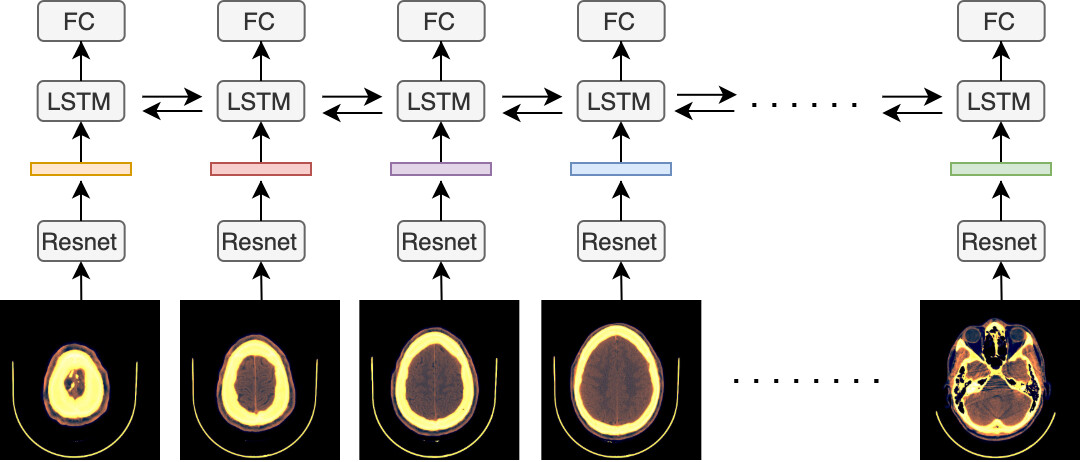 A CNN-LSTM Architecture for Detection of Intracranial Hemorrhage on CT ...