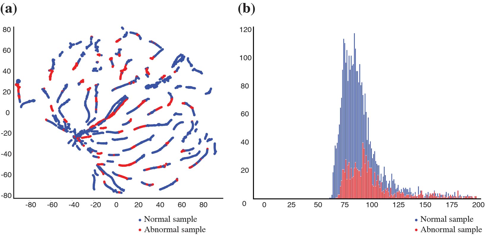 Unsupervised Brain Abnormality Detection Using High Fidelity Image Reconstruction Networks Deepai
