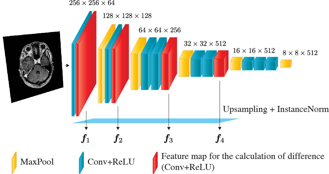 Unsupervised Brain Abnormality Detection Using High Fidelity Image Reconstruction Networks Deepai