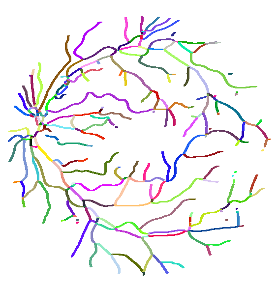 Joint Learning of Vessel Segmentation and Artery/Vein Classification ...