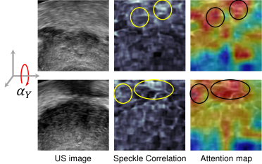 Sensorless Freehand 3D Ultrasound Reconstruction via Deep Contextual ...