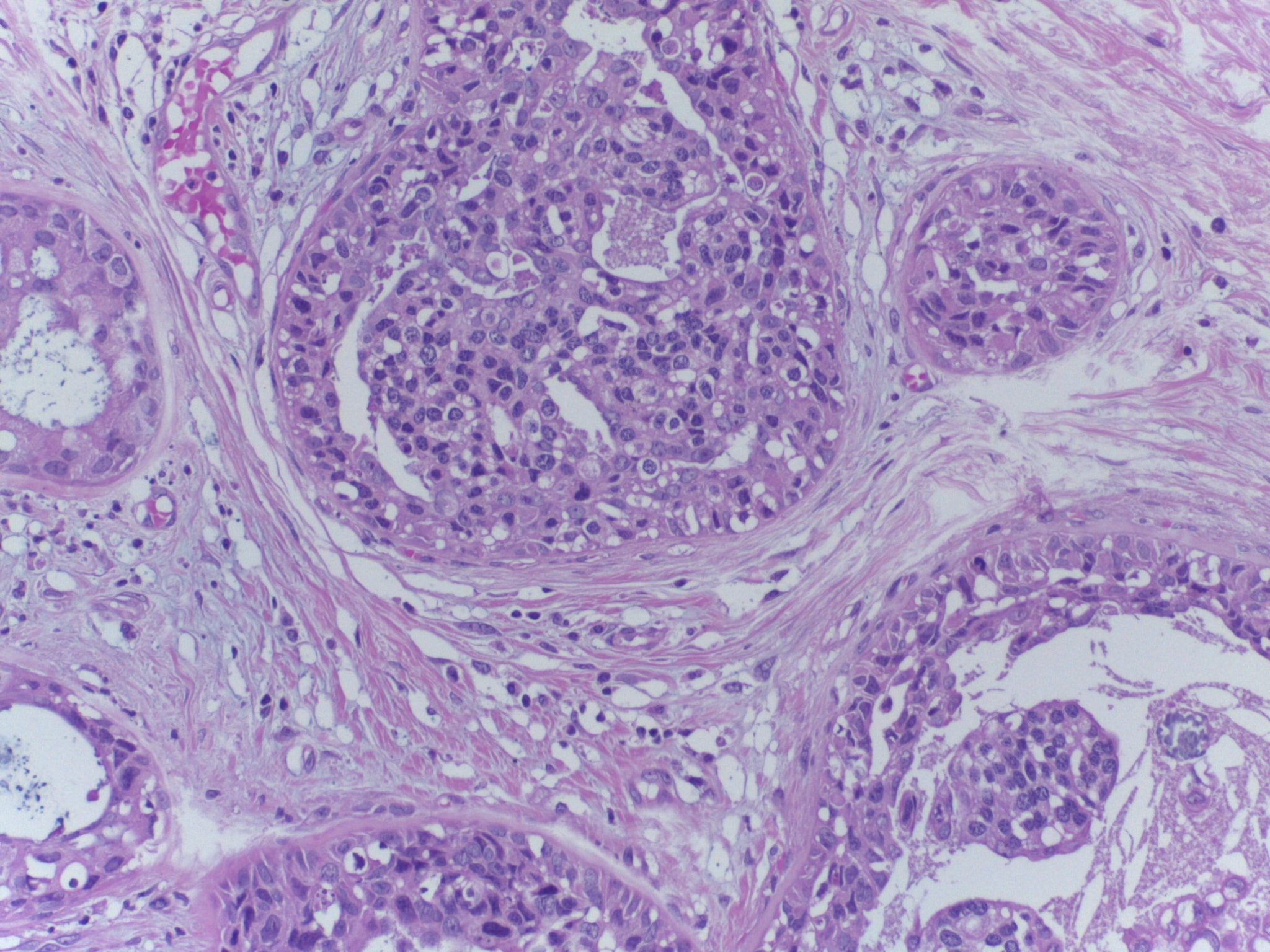 Visualization for Histopathology Images using Graph Convolutional ...