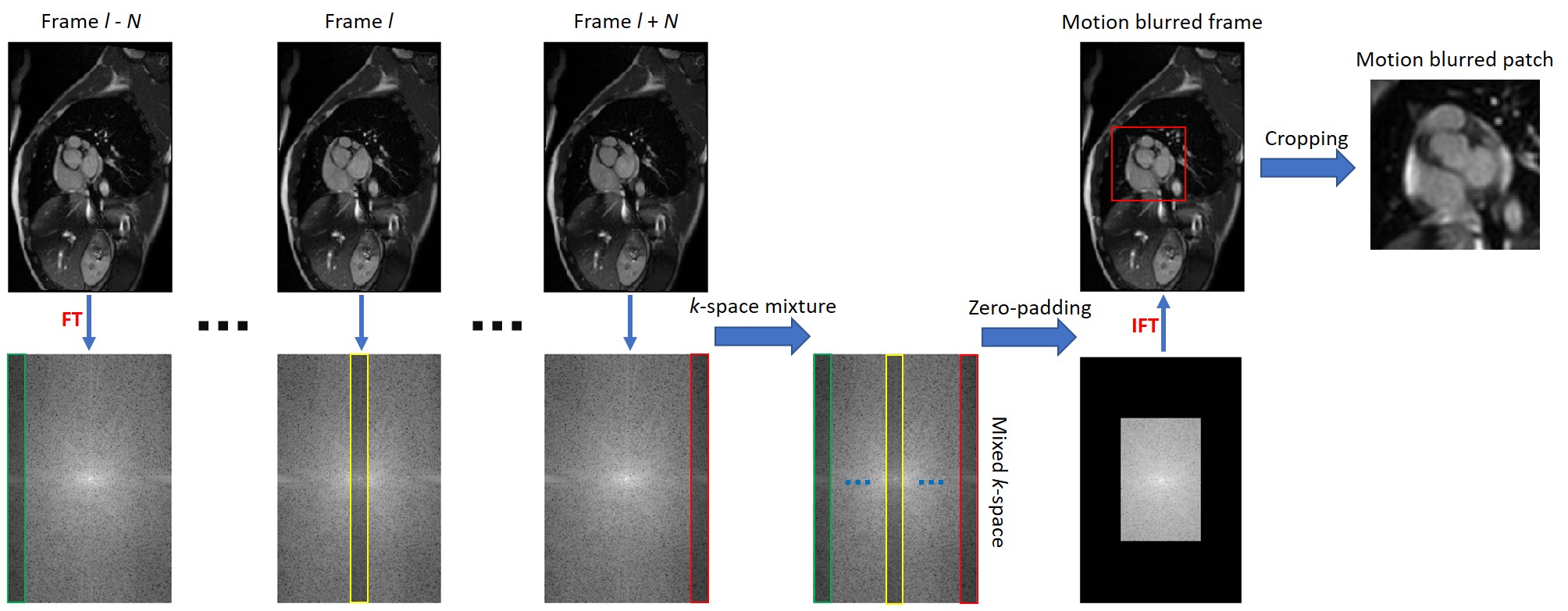 Cine Cardiac Mri Motion Artifact Reduction Using A Recurrent Neural Network Deepai