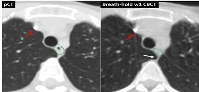Generalizable Cone Beam CT Esophagus Segmentation Using In Silico Data Augmentation | DeepAI