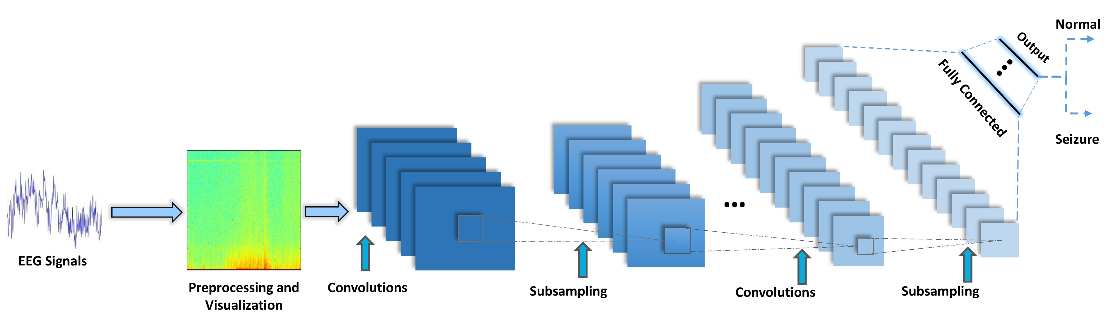 Epileptic Seizure Detection Using Deep Learning Techniques A Review