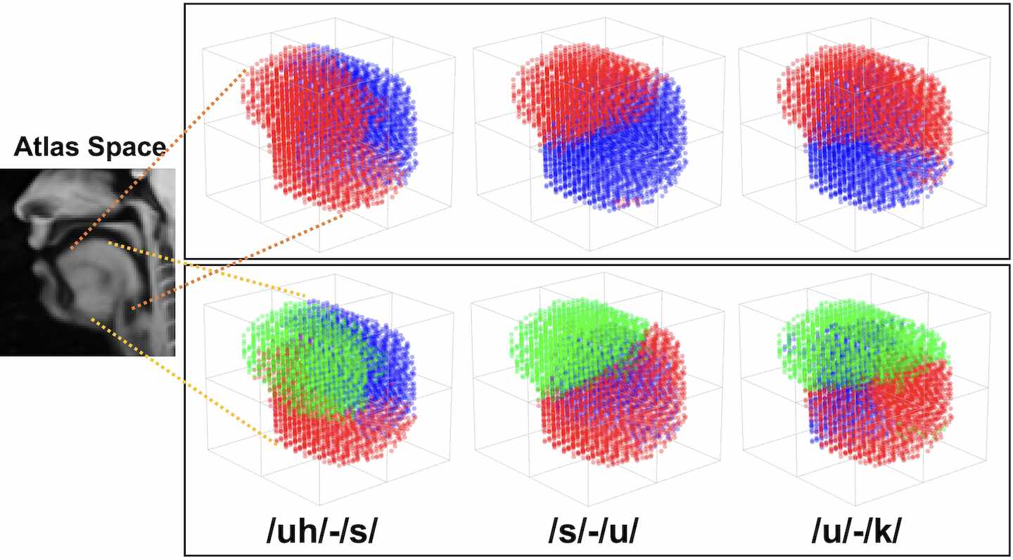 A Deep Joint Sparse Non Negative Matrix Factorization Framework For Identifying The Common And