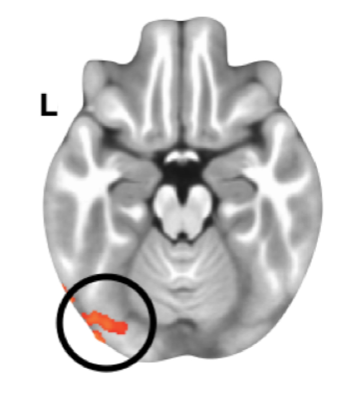 Visual Explanation for Identification of the Brain Bases for Dyslexia ...