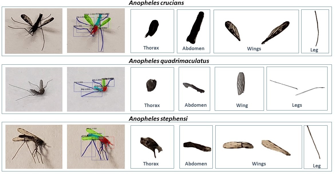 A Framework based on Deep Neural Networks to Extract Anatomy of ...