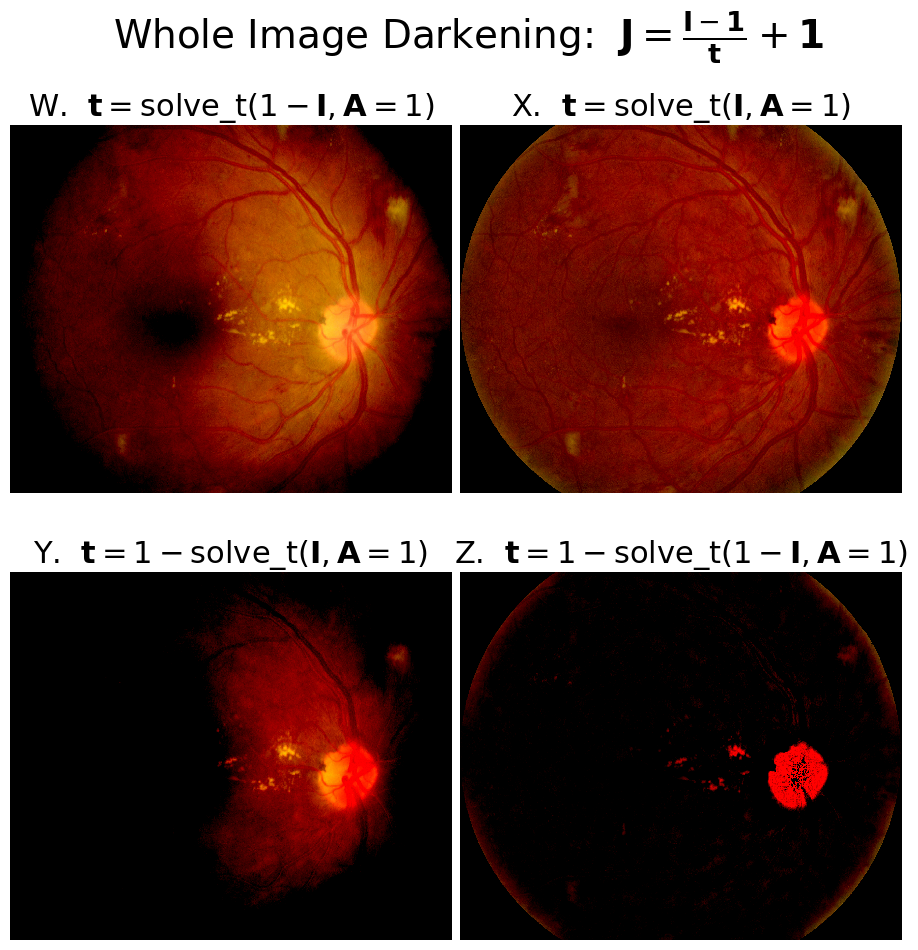 Enhancement of Retinal Fundus Images via Pixel Color Amplification | DeepAI
