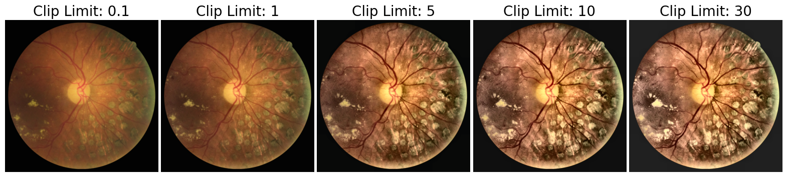 Enhancement of Retinal Fundus Images via Pixel Color Amplification | DeepAI
