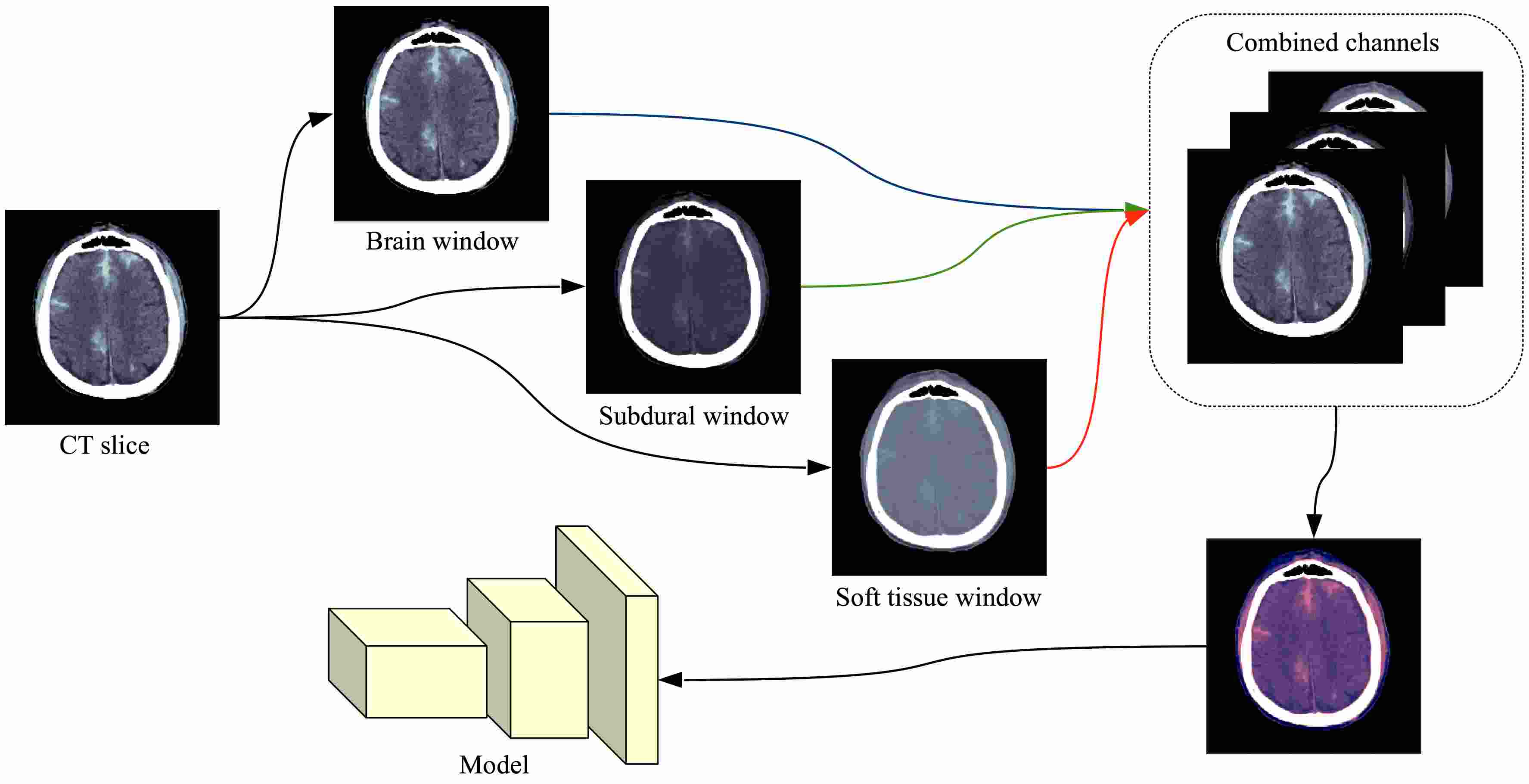 Accurate and Efficient Intracranial Hemorrhage Detection and Subtype ...