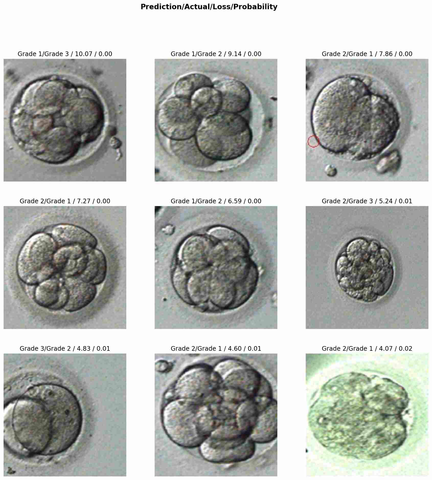 Human Blastocyst Classification after In Vitro Fertilization Using Deep ...