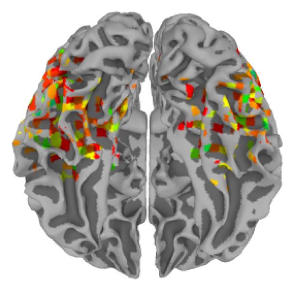 Deep Representational Similarity Learning for analyzing neural ...