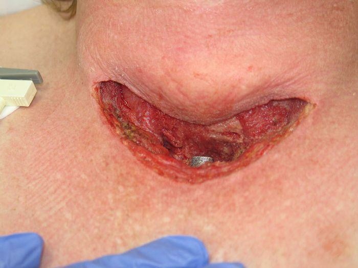 Multiclass Wound Image Classification using an Ensemble Deep CNN-based ...