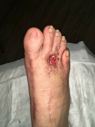 Multiclass Wound Image Classification using an Ensemble Deep CNN-based ...