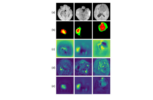 Inter Slice Context Residual Learning For 3d Medical Image Segmentation Deepai
