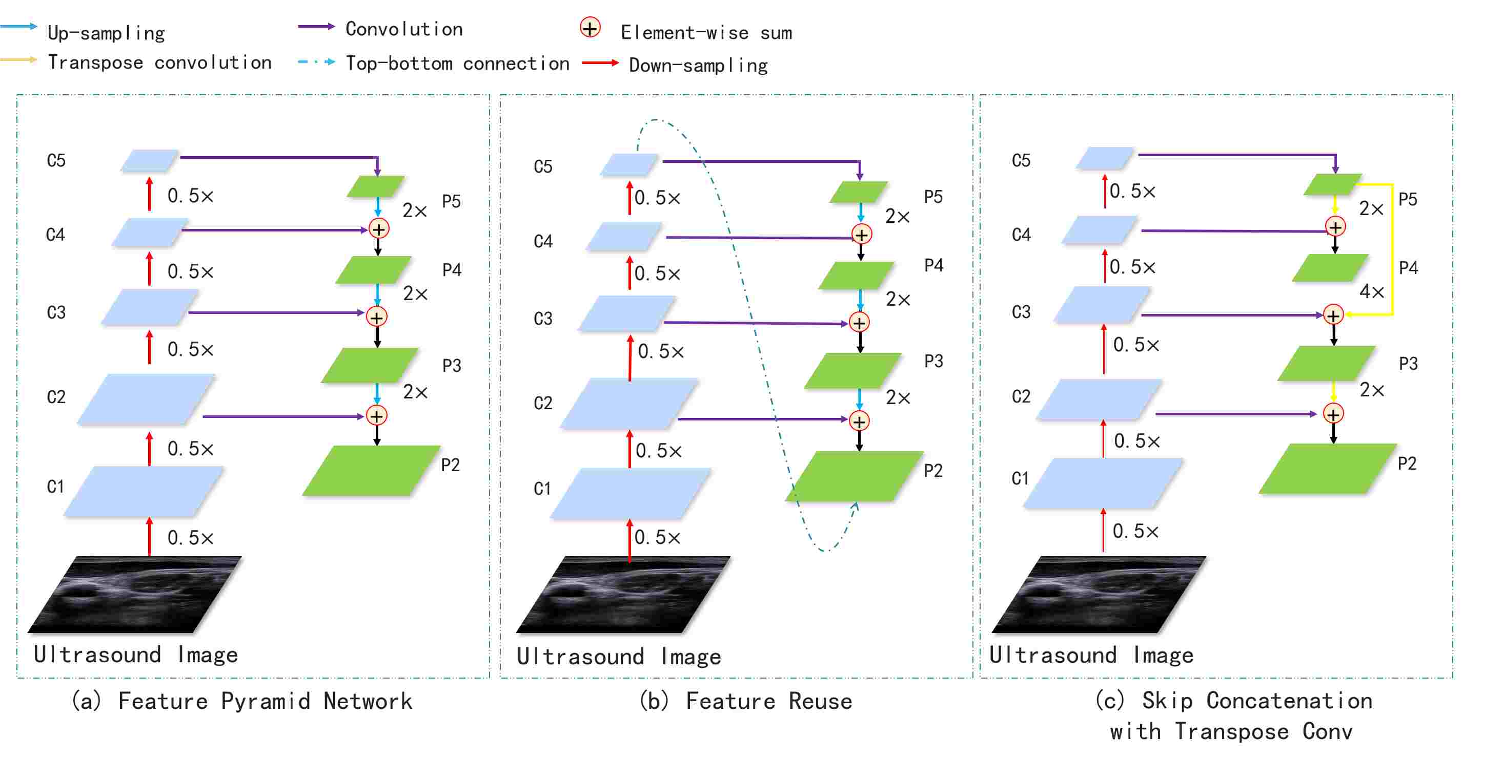 Multiple Instance Segmentation in Brachial Plexus Ultrasound Image Using BPMSegNet | DeepAI