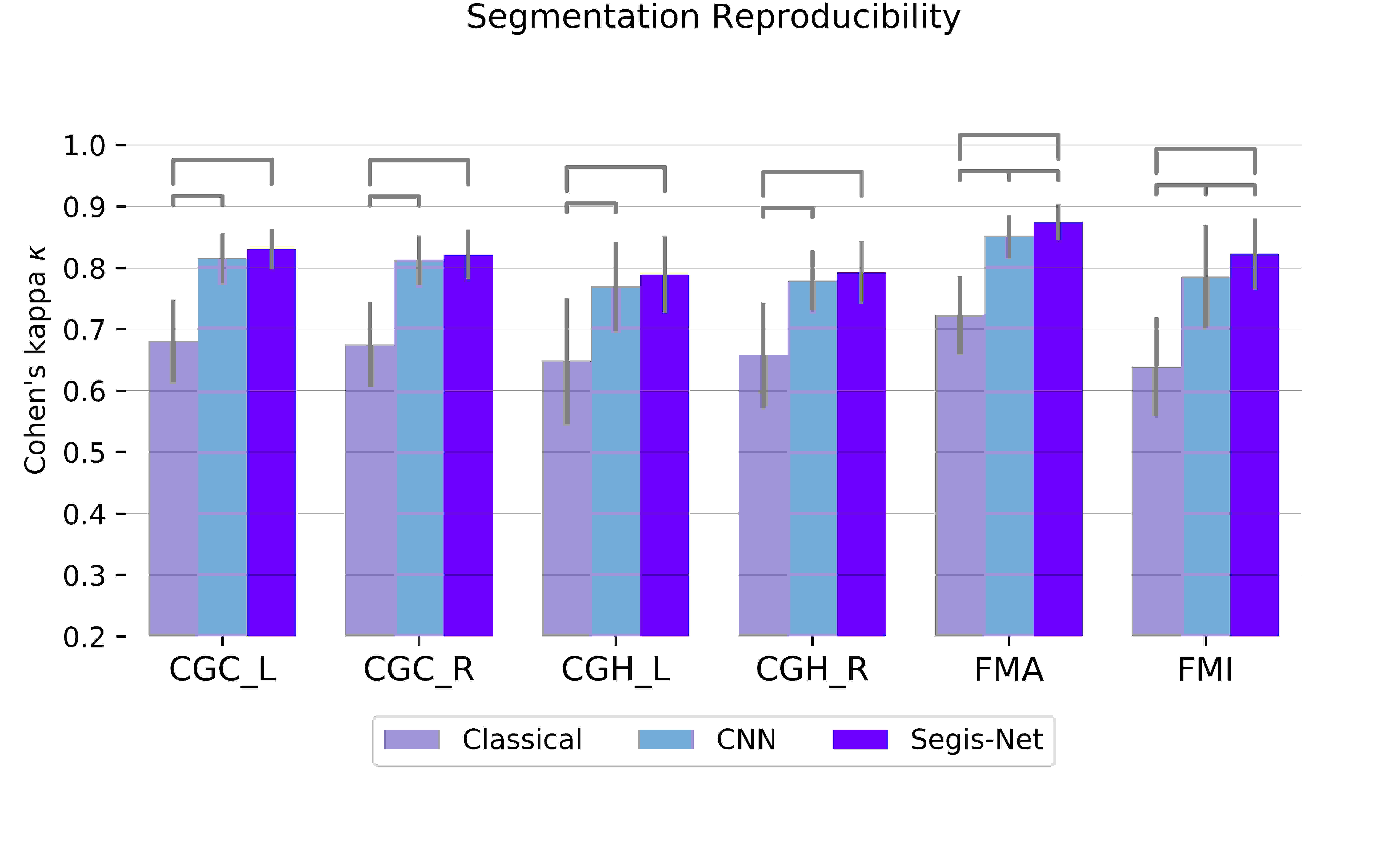 Longitudinal Diffusion Mri Analysis Using Segis Net A Single Step Deep Learning Framework For