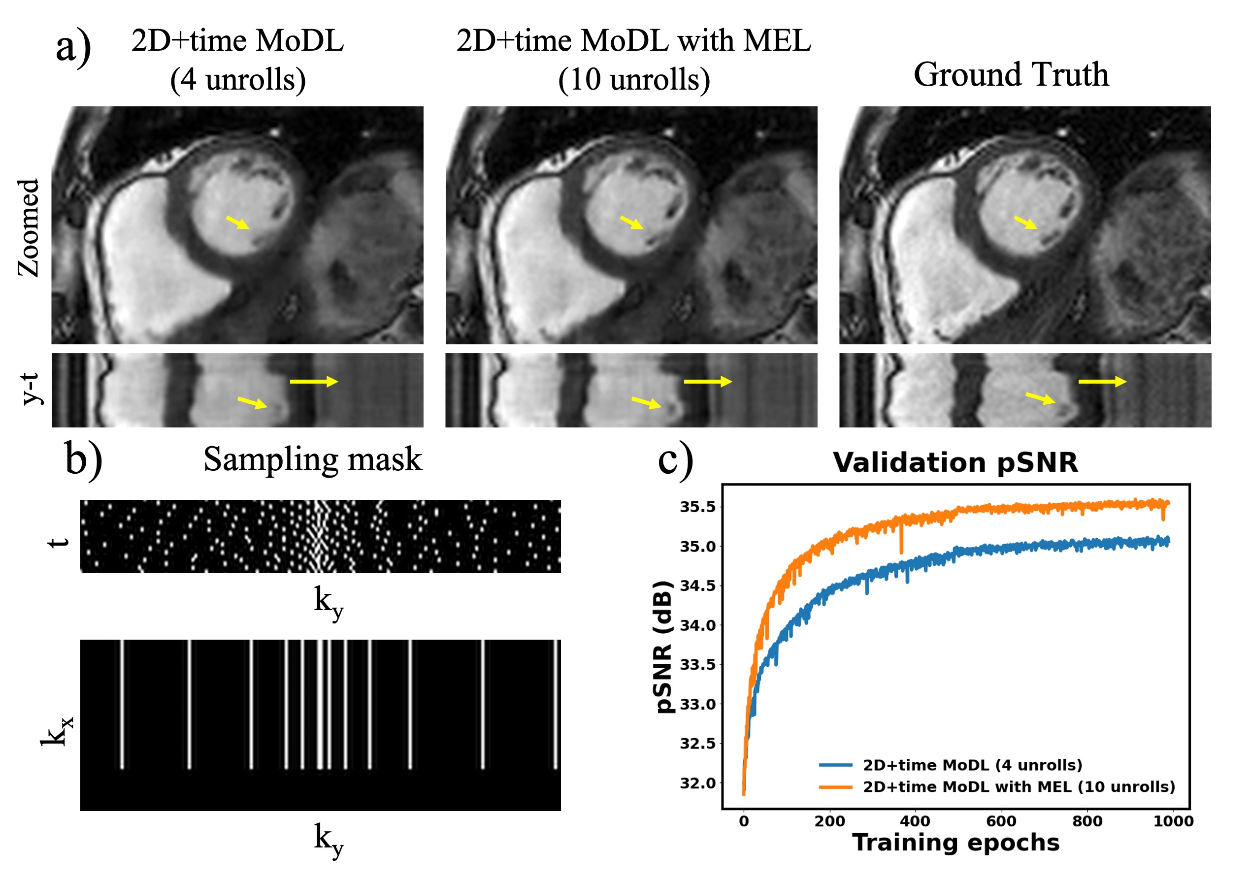Memory-efficient Learning for High-Dimensional MRI Reconstruction | DeepAI