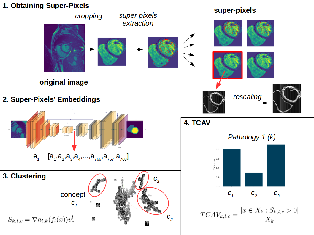 Interpretability of a Deep Learning Model in the Application of Cardiac ...