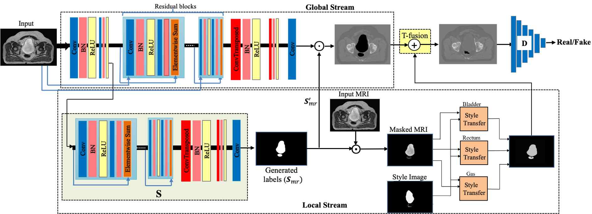 SA-GAN: Structure-Aware Generative Adversarial Network for Shape-Preserving Synthetic CT ...