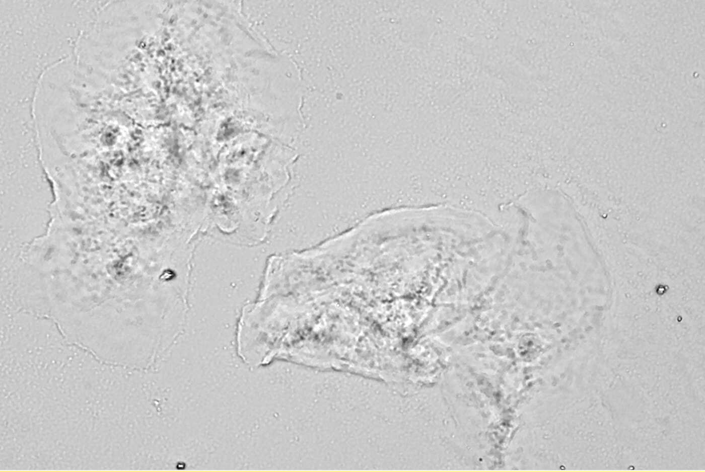 What is the State of the Art of Computer Vision-Assisted Cytology? A ...