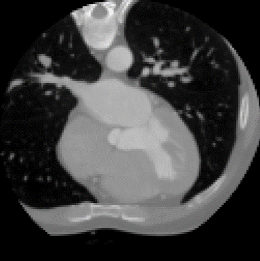 Cardiac Segmentation on CT Images through Shape-Aware Contour ...