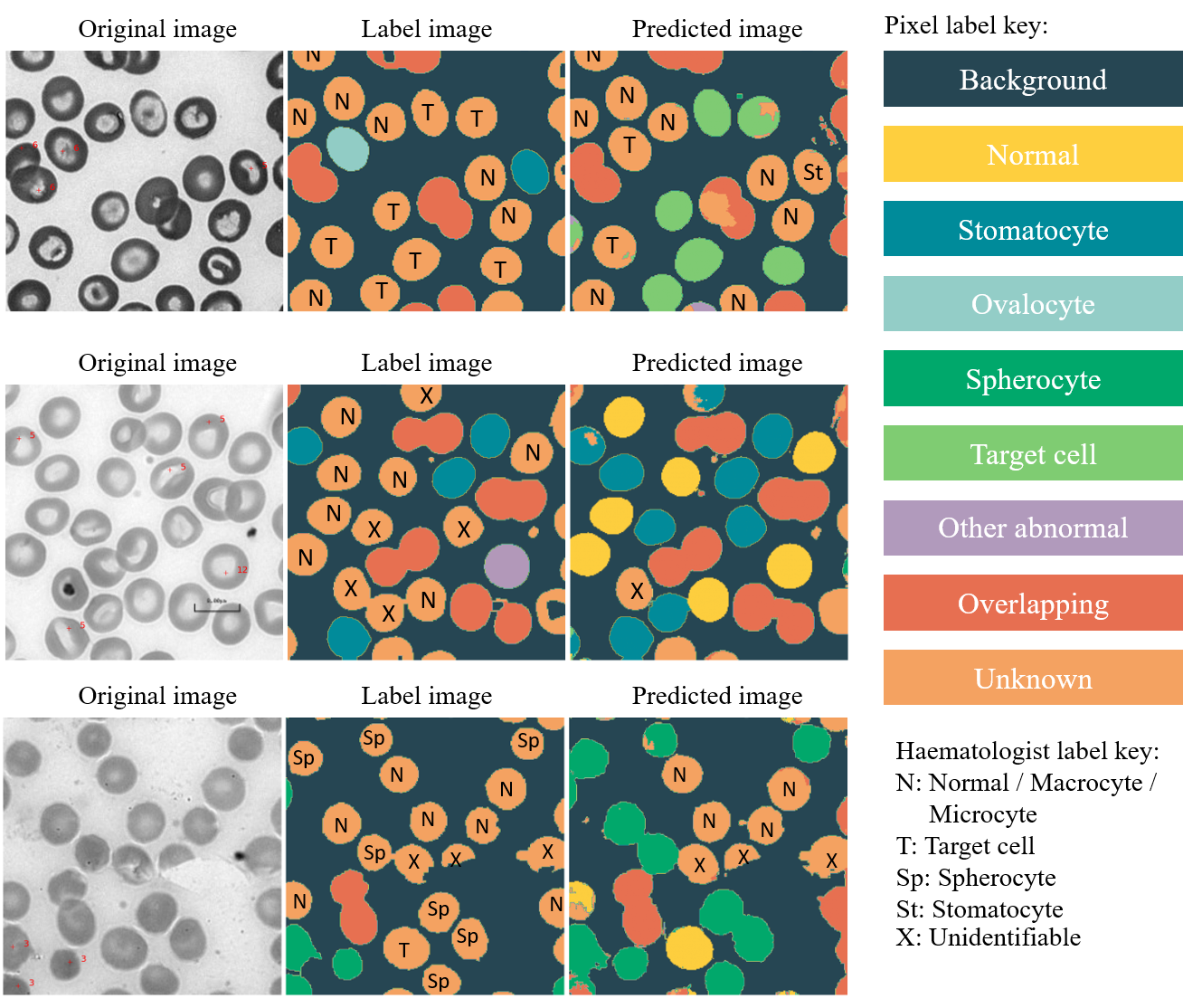 Analysis of Vision-based Abnormal Red Blood Cell Classification | DeepAI