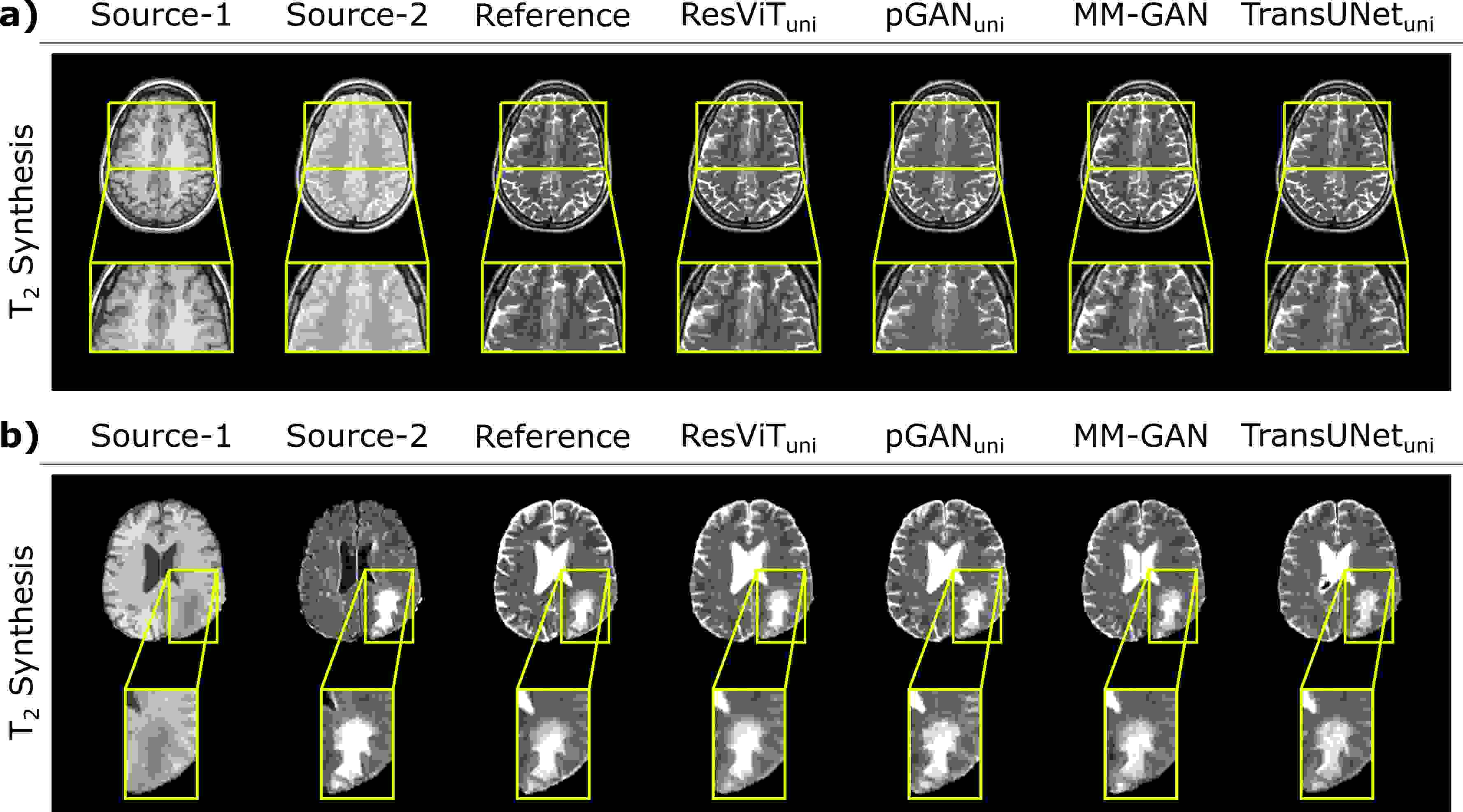 ResViT: Residual vision transformers for multi-modal medical image ...